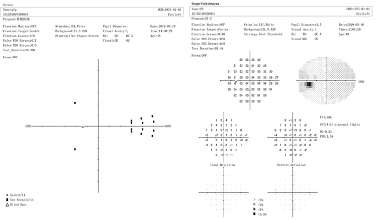 CE Approved Auto Perimeter Price BIO-1000 in China