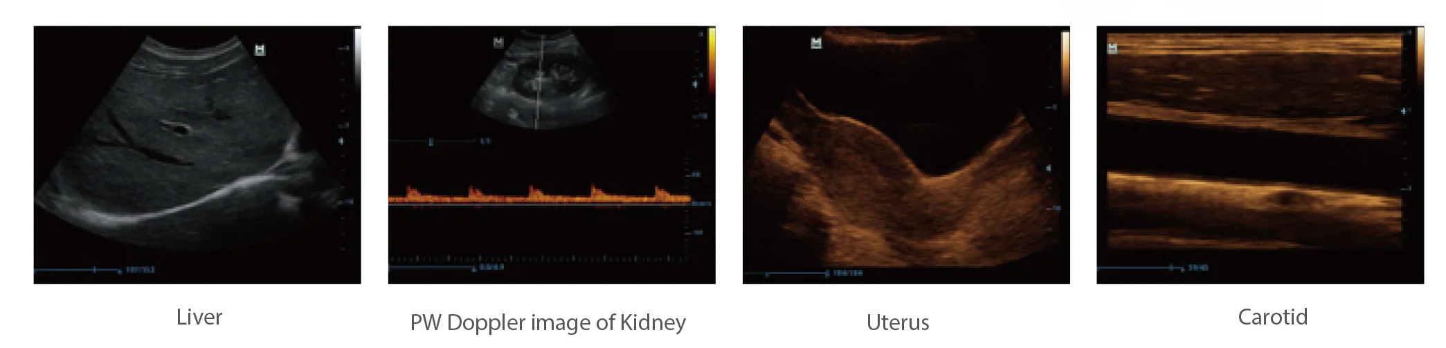 Mindray Dp30 Portable Ultrasound Machine Price / Mindray Dp10 With Pw ...