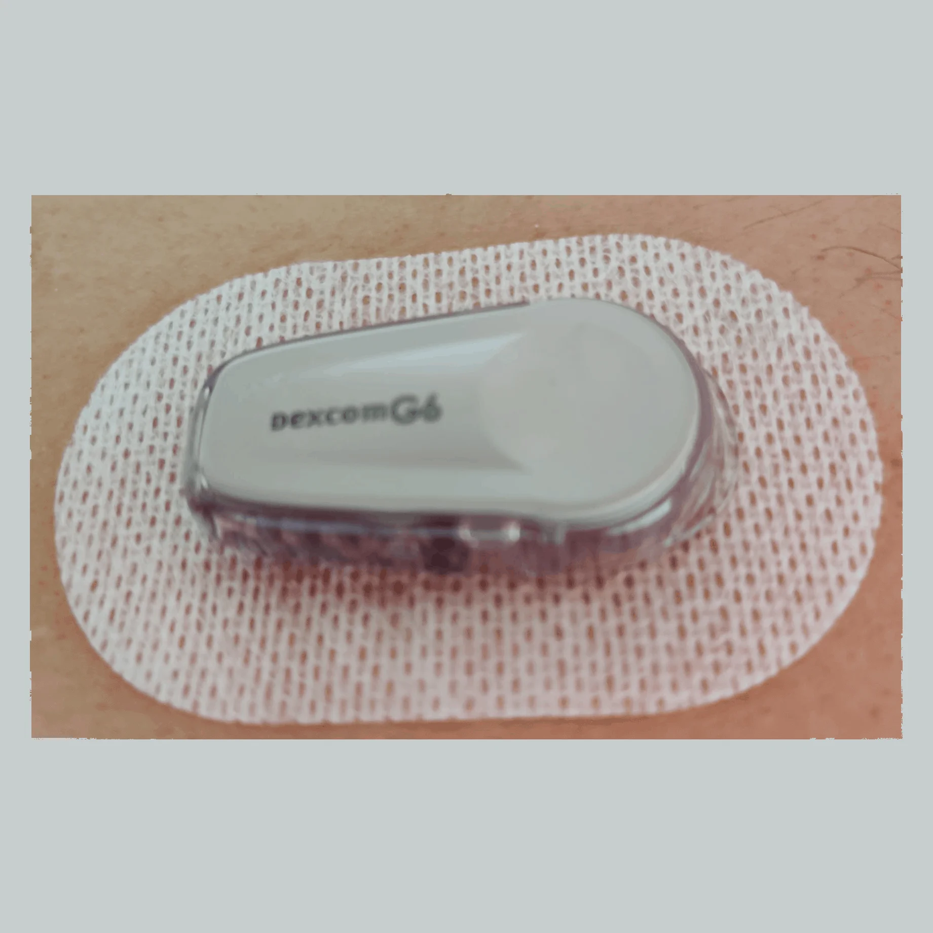 Hot Sale Factory Dexcom G6 Sensors Transmitter Diabetes Portable Blood ...