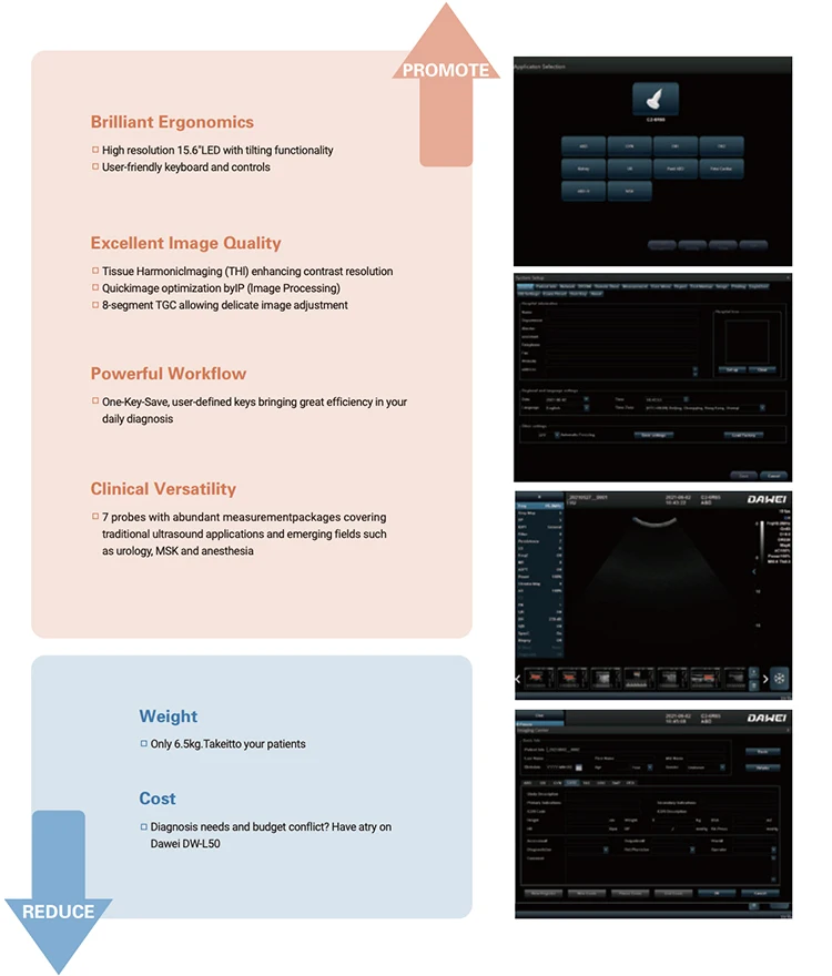 Dawei DW-L50 Portable Ultrasound Machine - 3D/4D/5D