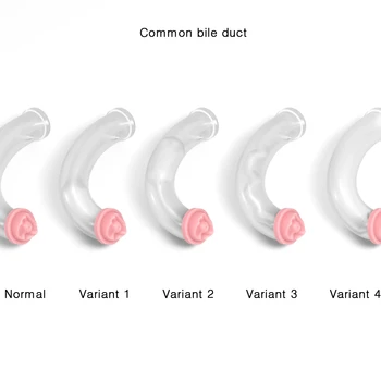 Common Bile Duct Model For Ercp Endoscopic Retrograde ...