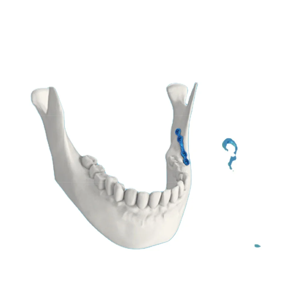 Anatomical 2d Round Hole Metal Maxillofacial Plate Neurosurgery Cranial ...