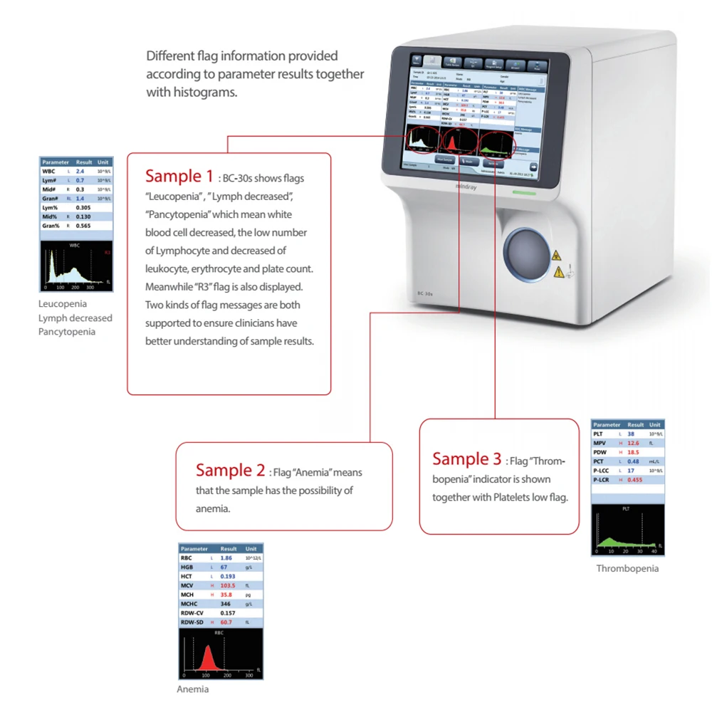 Mindray Bc-30s Hematology Analyzer - Efficient Blood Counting