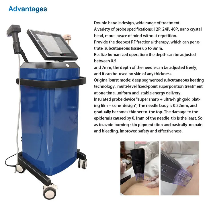 Morpheus 8 Fractional RF Microneedling: Skin Rejuvenation, Tightening ... Morpheus 8 Fractional RF Microneedling: Skin Rejuvenation, Tightening ...