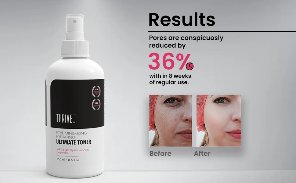 Best Selling Pore Tightening Toner Spray For Men & Women Uniform ...