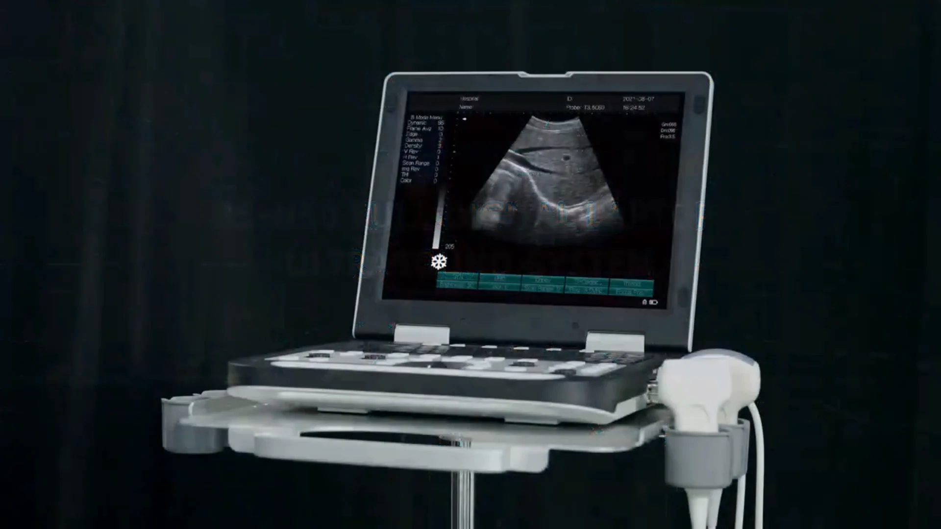 Rs-n50 Laptop Ultrasound Machine& Cheap Bw Ultrasound Scanner With ...