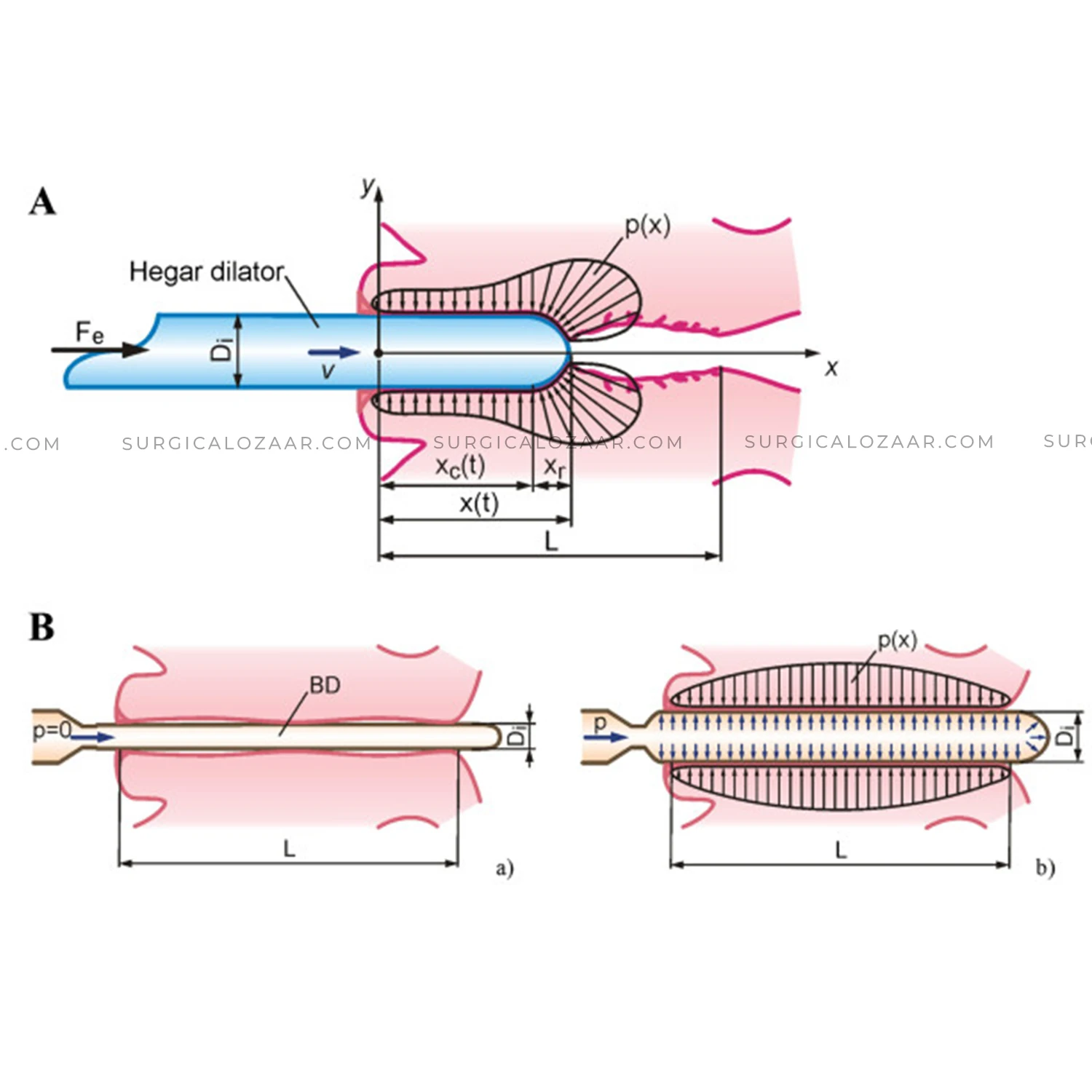 Hegar Sound Dilator Set Of 8 Double Ended Hollow Sound Dilators 3mm To ...