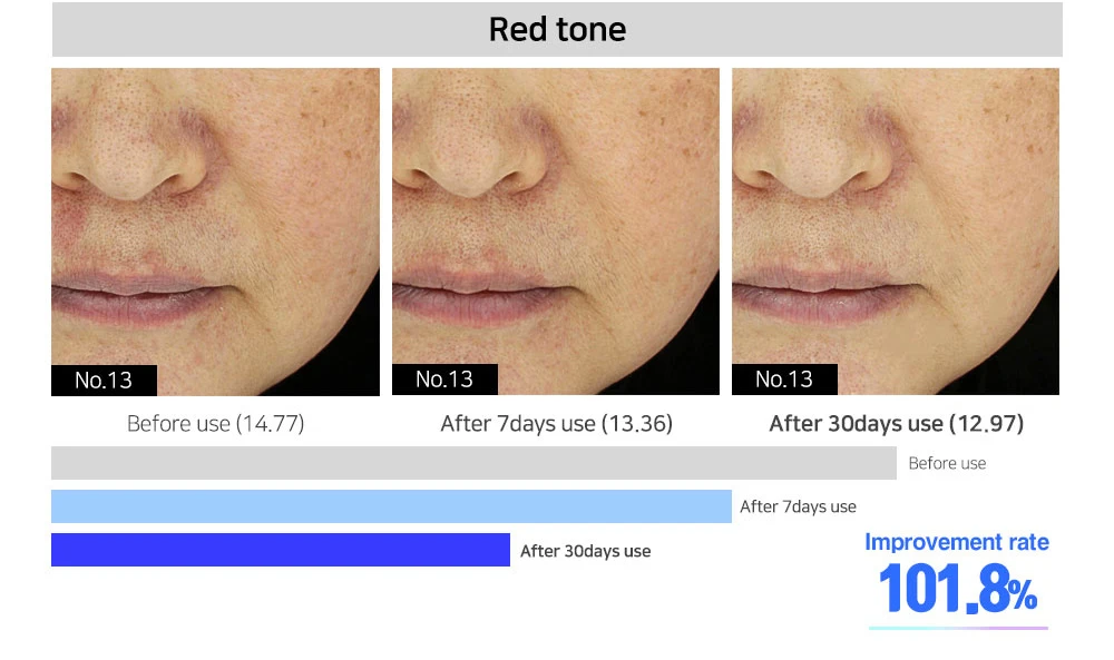 Korean Skincare Set Intensive Whitening Vitamin Three Type 7 Daus ...