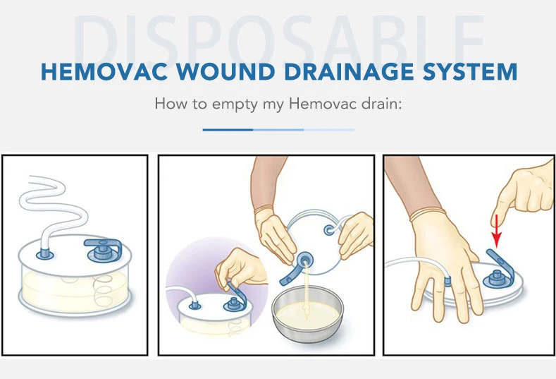 400ml Hemovac Wound Drainage System - Efficient & Reliable