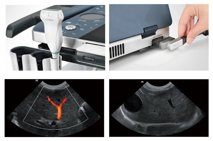 Mindray Vetus E7 Portable Ultrasound Imaging System for Veterinary Use ...