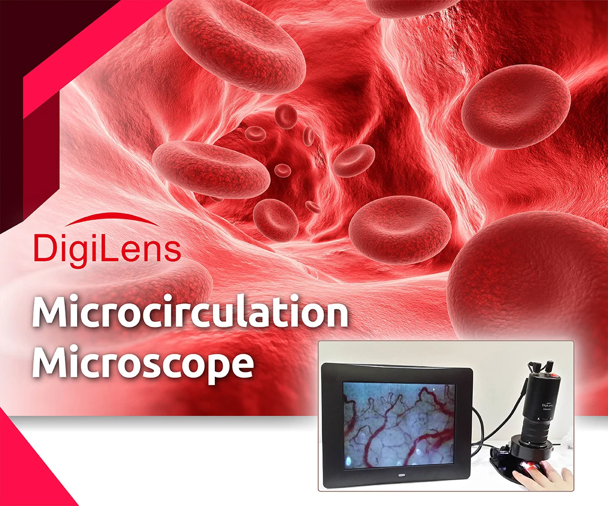 Blood Capillary Microcirculation Microscope - 320x Magnification