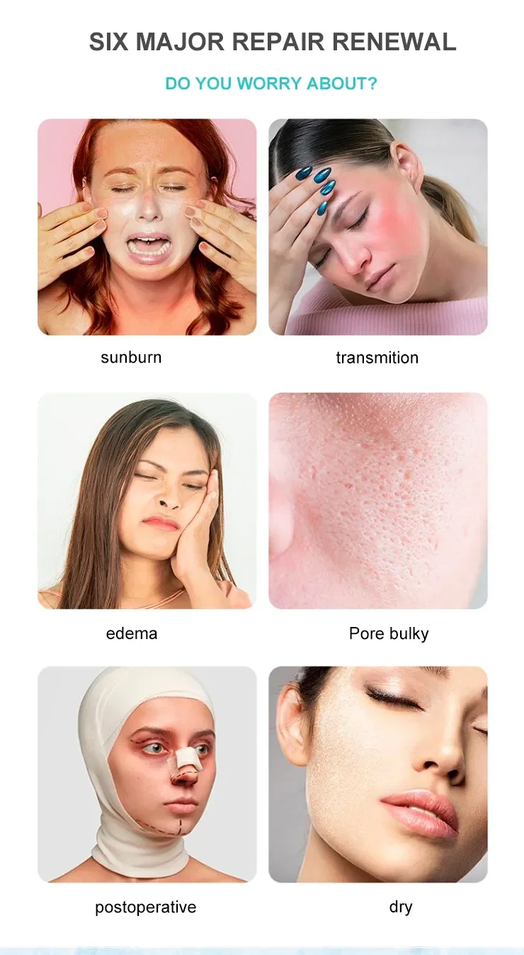 Ice Cube Face Lifting Cooling Roller Massage Ice Mold Cube Roller ...