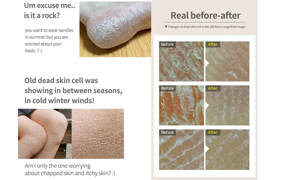 Dermagen Urea Cream - Intense Moisturizing for Dry Skin