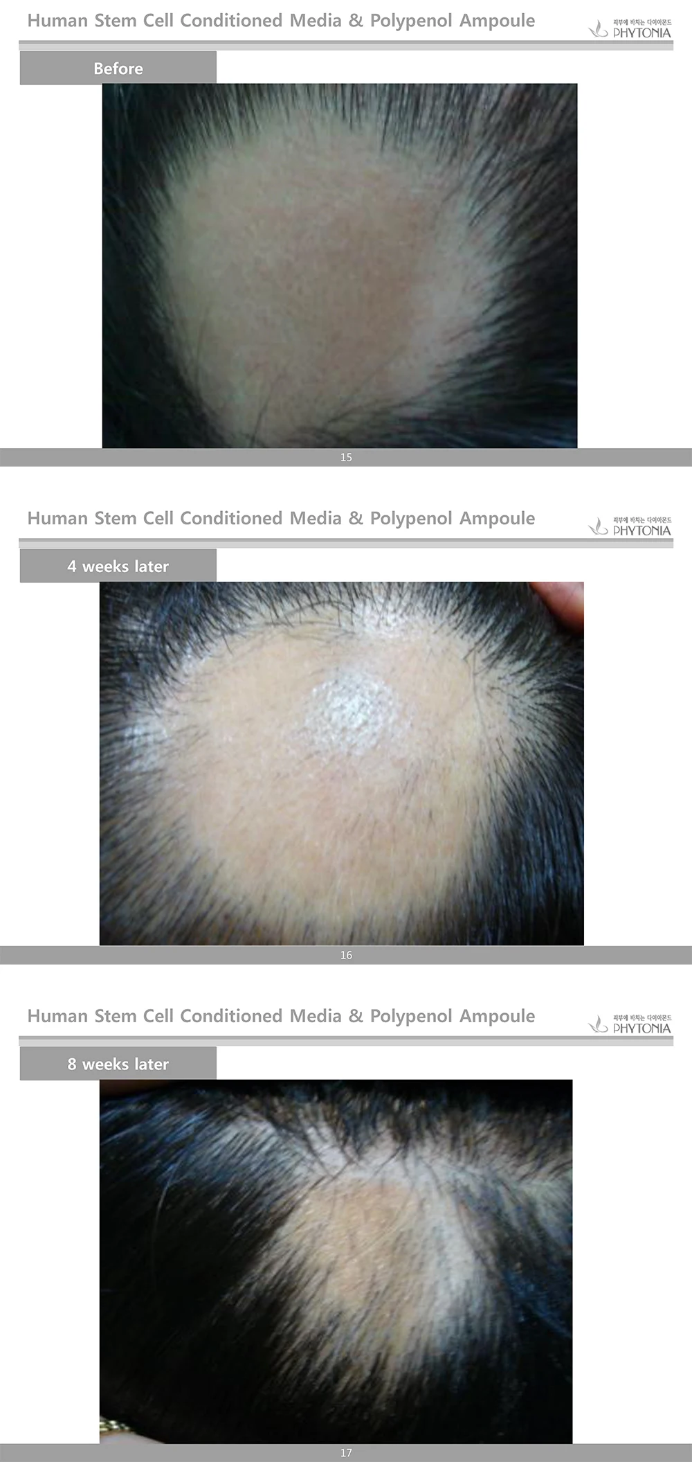 Phy-tox Senolytic Lotion Anti-aging And Cell Regeneration New Skincare ...