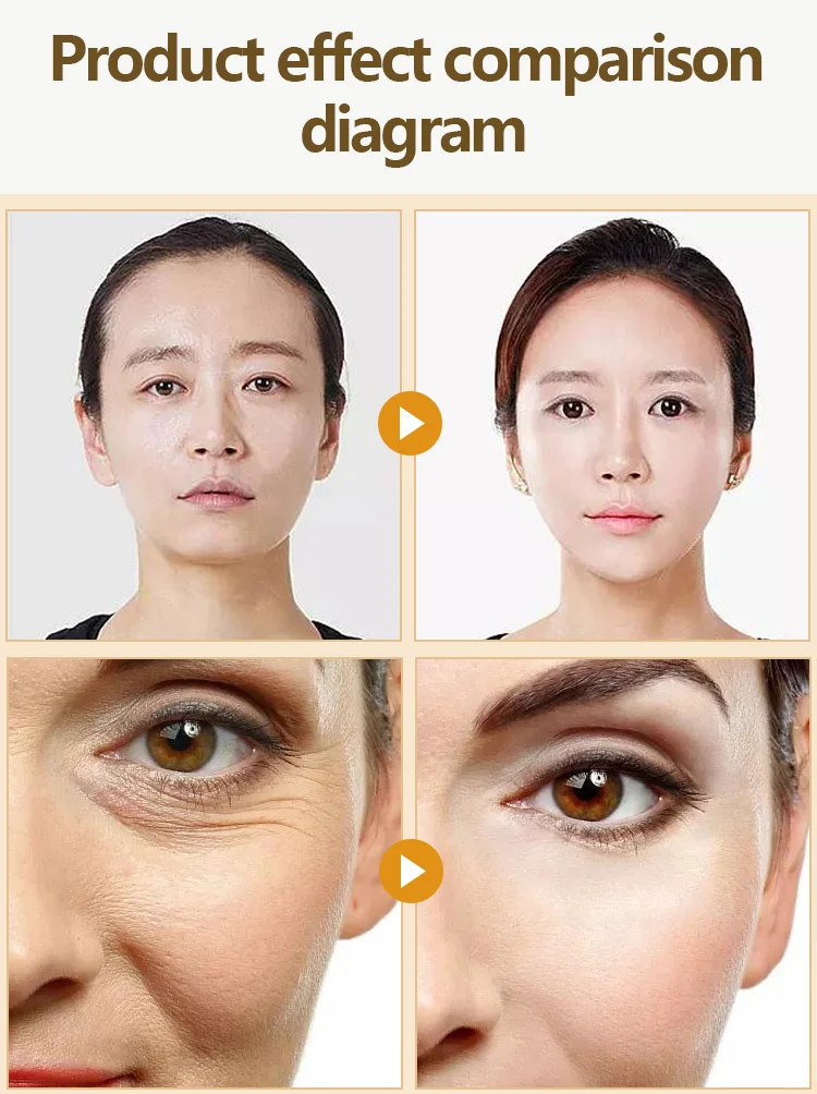 Protein Thread Lifting Set Soluble Protein Thread And Nano Gold Essence ...