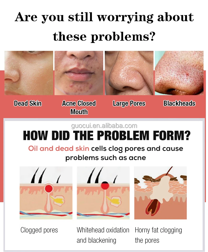 Fatazen Salicylic Acid 2% Solution Aha 30% + Bha 2% Peel Solution ...