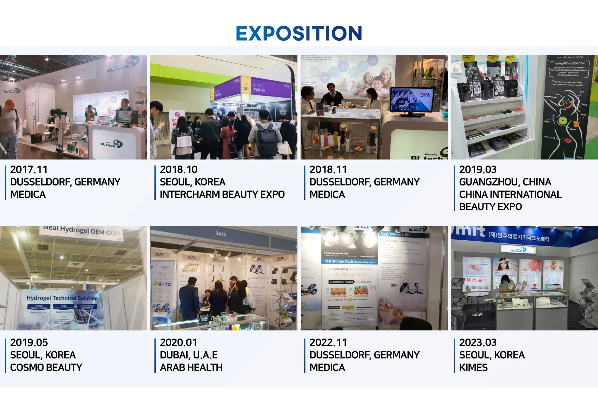 Bl Tech Neal Splint Orthopedic Splint Nw F Fiberglass Single Polyester ...