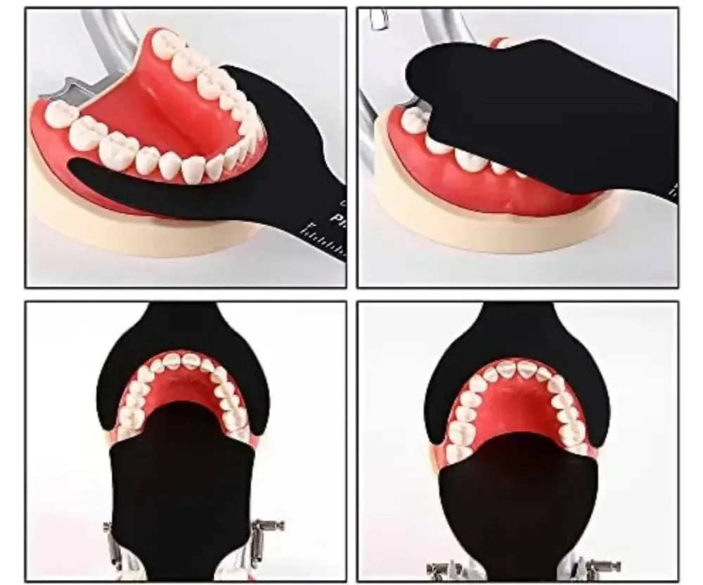 Dental Photo Contrast Black Background Board Orthodontic Intraoral ...