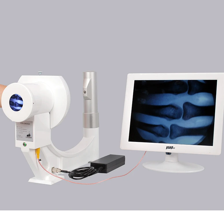 High Quality Portable Xray Perspective Apparatus Fluoroscopical Machine ...