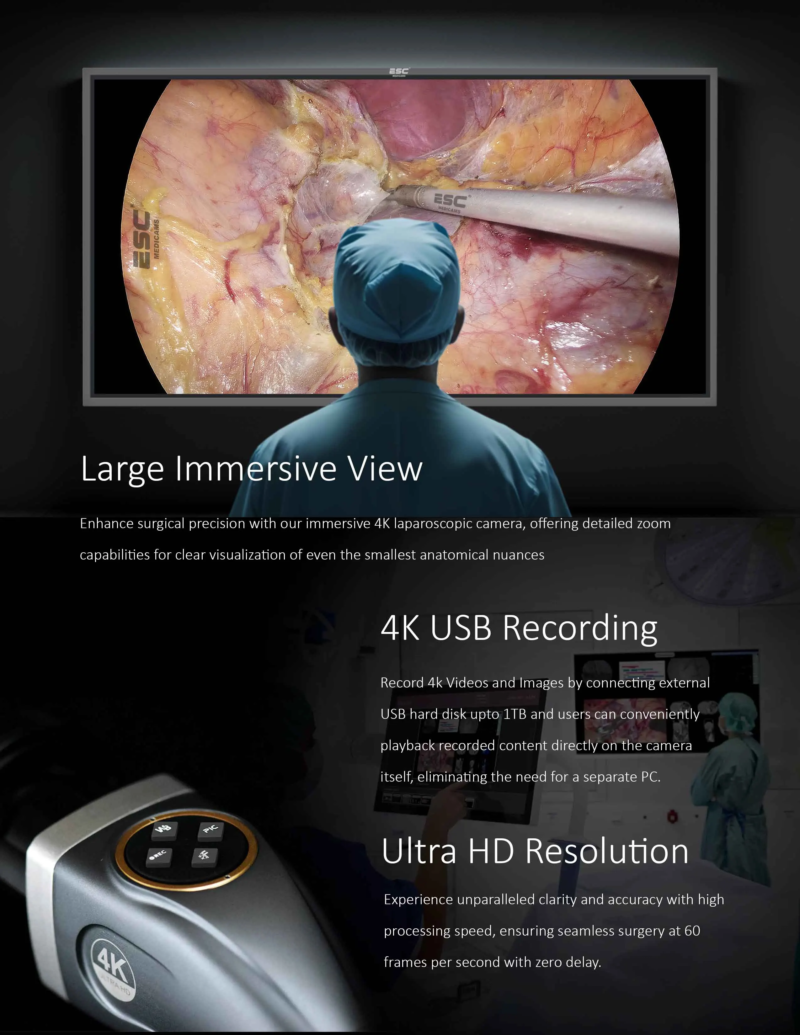 4K Ultra HD Laparoscopic Camera System by ESC Medicams