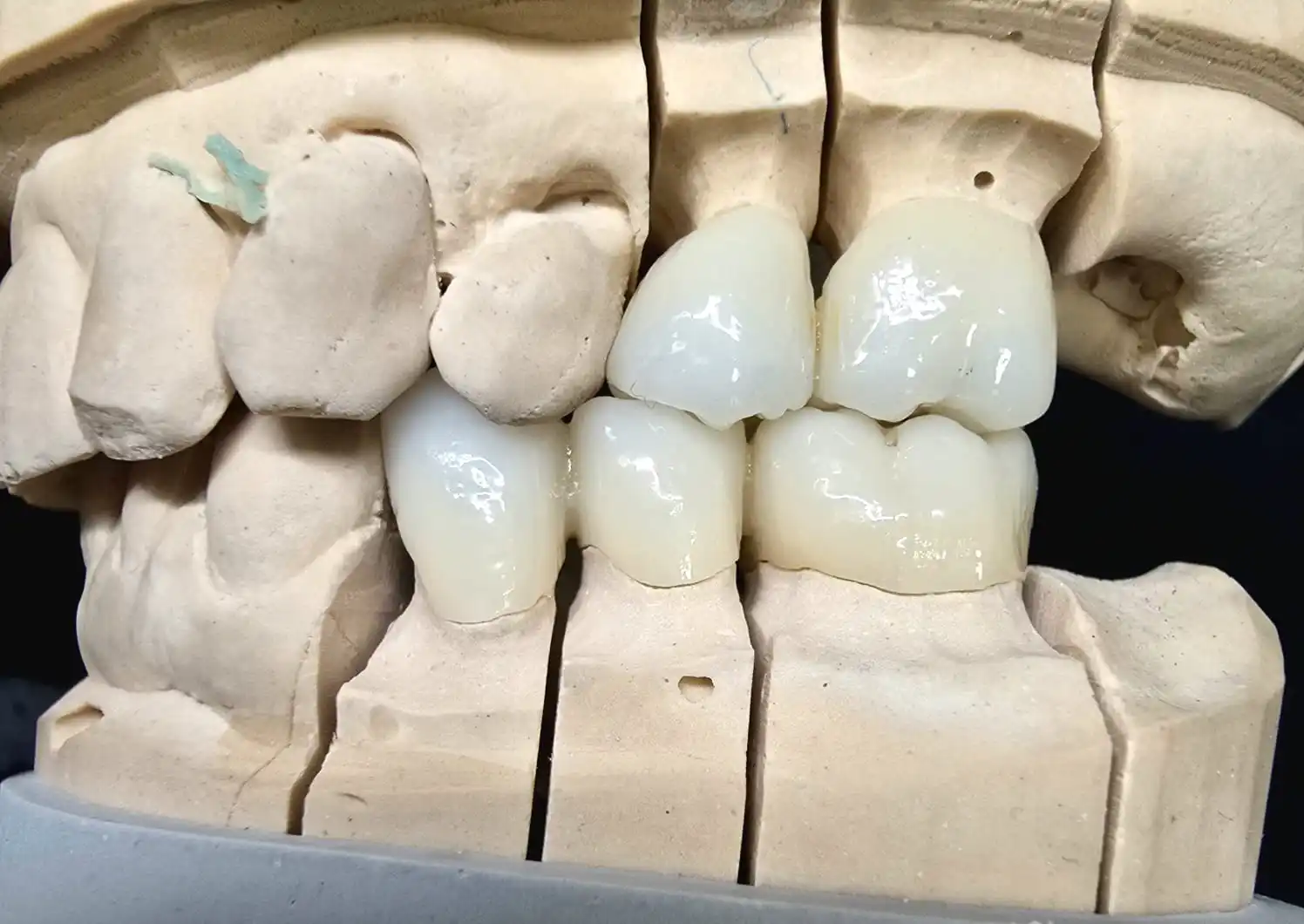 4D Dental Zirconium Block - Premium Zirconia Materials