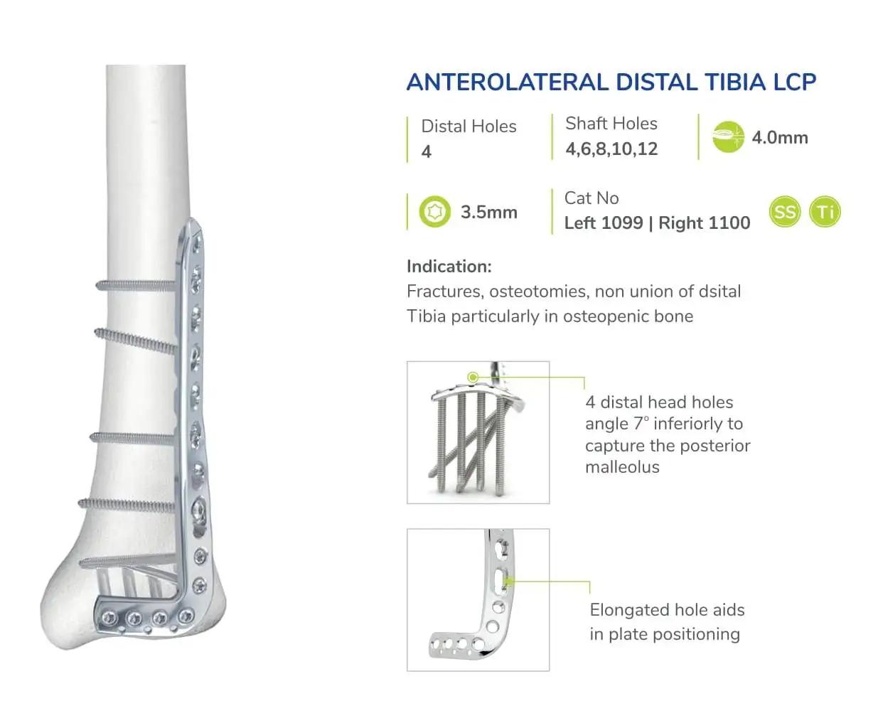 Anterolateral Distal Tibia Locking Compression Plate Kinein Orthopedic ...