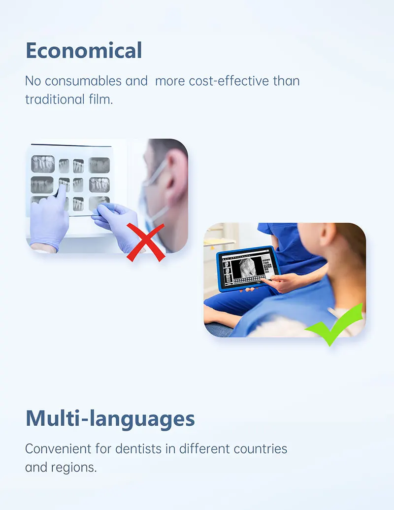 Dental Intraoral X-ray Sensor R1/ R2 Intraoral Digital Imaging System ...