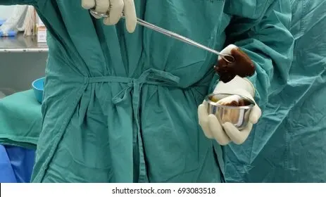 Surgical Sponge Retrieval And Holding Forceps For Precise And Safe ...
