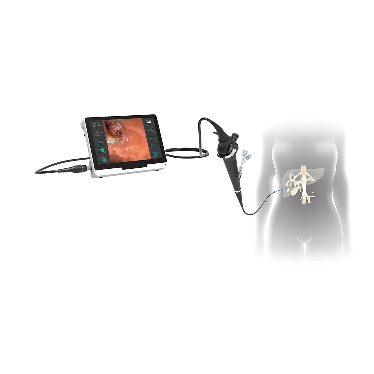 Flexible Video Choledochoscope for PTCS Surgery & Diagnosis