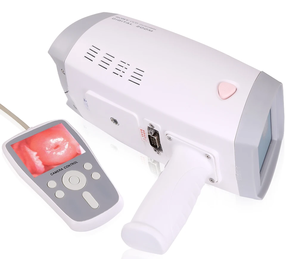 Digital Vaginal Speculum Camera Colposcope Digital Video Colposcope for ...