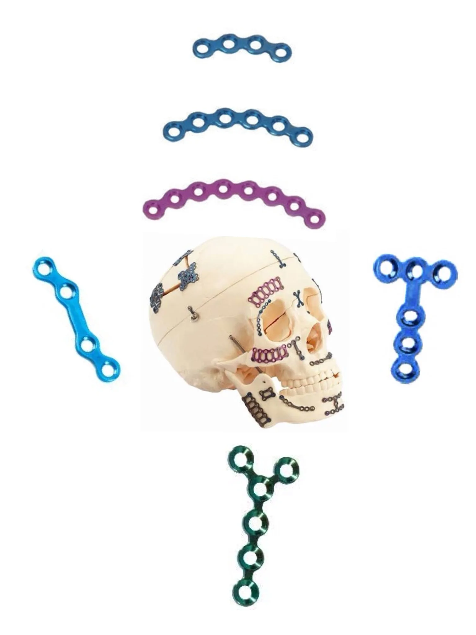 Anatomical 2d Round Hole Metal Maxillofacial Plate Neurosurgery Cranial ...