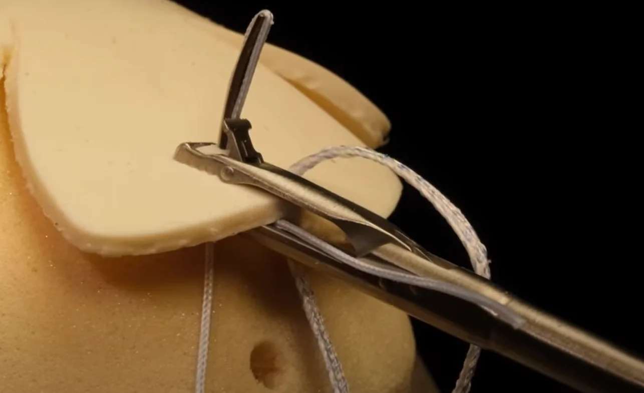 Suture Passer Shoulder Joint Arthroscopy Rotator Cuff Labral Repair ...