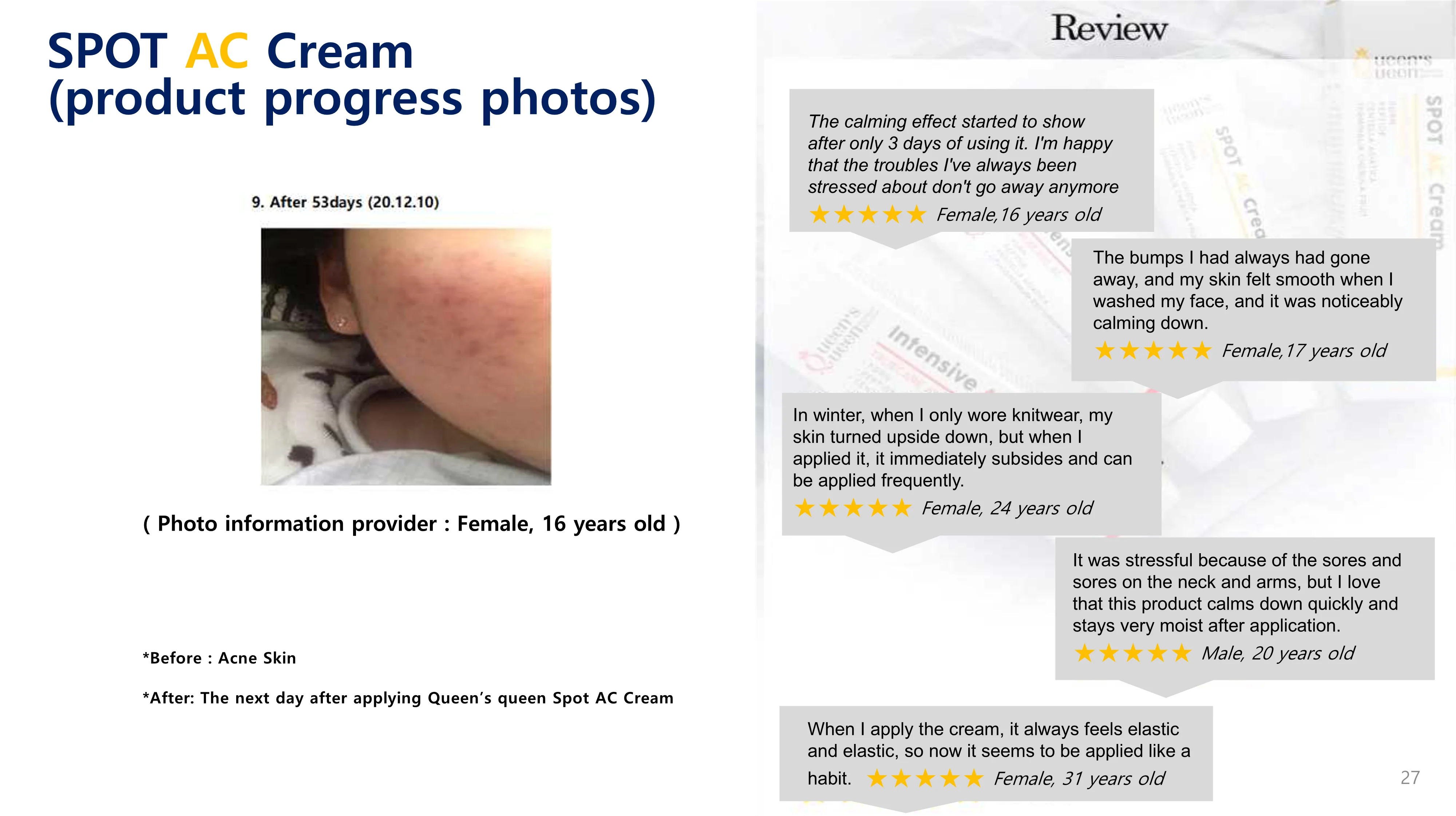 Facial Creams Queen's Queen Spot Ac Cream 50ml Skin Regeneration And ...