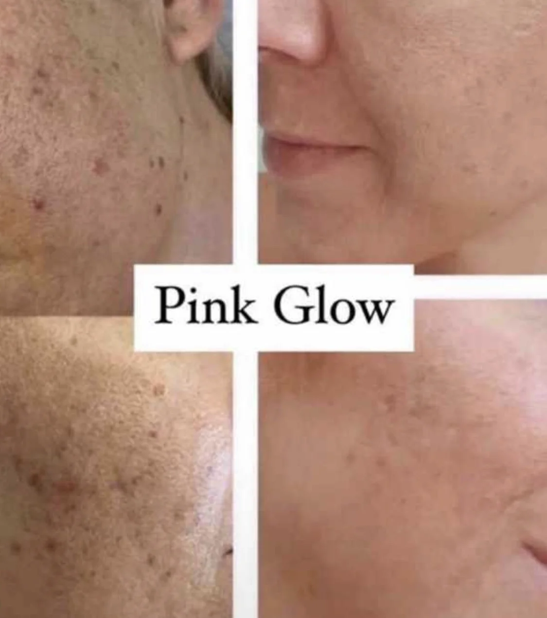 Korean Koru Pharma Skin Brightening Therapy Powered By Age-defying ...