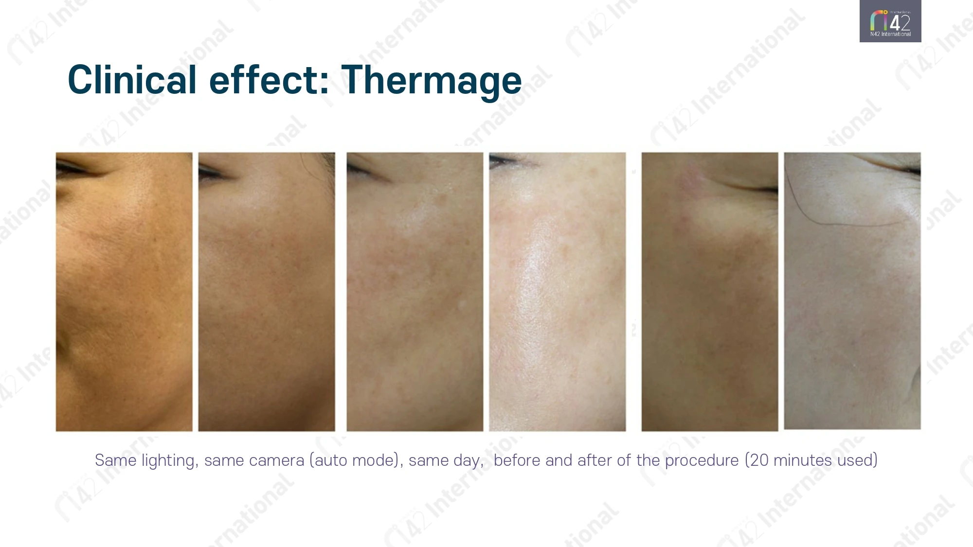 Made In Korea Rf4 Sharp Cream Gold Nano Particle Penetrates Into The ...