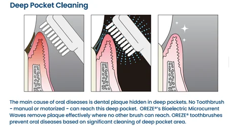 Bestgreen Tromatz Electromagnetic Wave Toothbrush - Total Oral Care