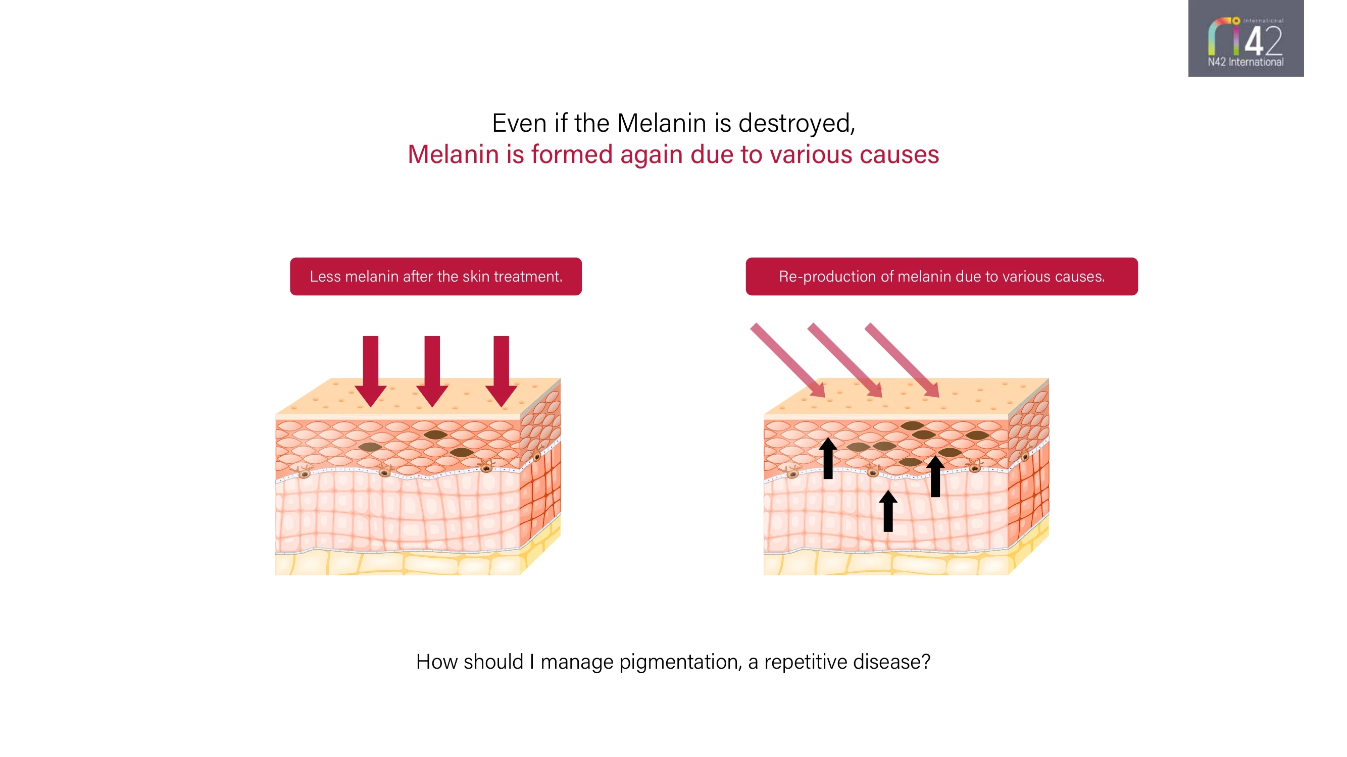 Made In Korea Fomellacys Odt Cream Pack Effect For Removing Melasma And ...