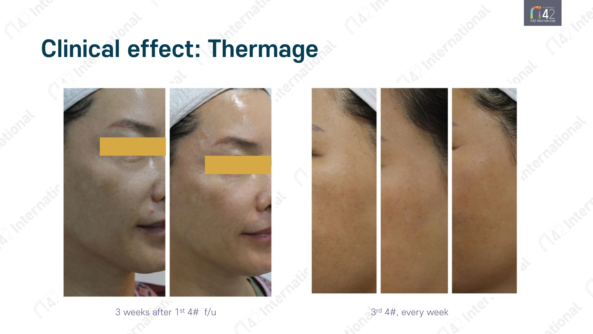 Made In Korea Rf4 Sharp Cream Gold Nano Particle Penetrates Into The ...