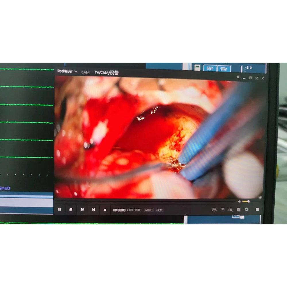 16 Channels Intraoperative Monitoring IONM System MSLCW37