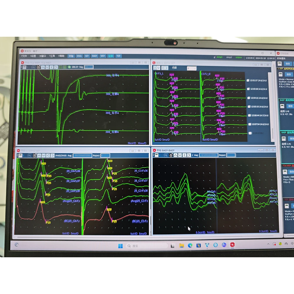 16 Channels Intraoperative Monitoring IONM System MSLCW37