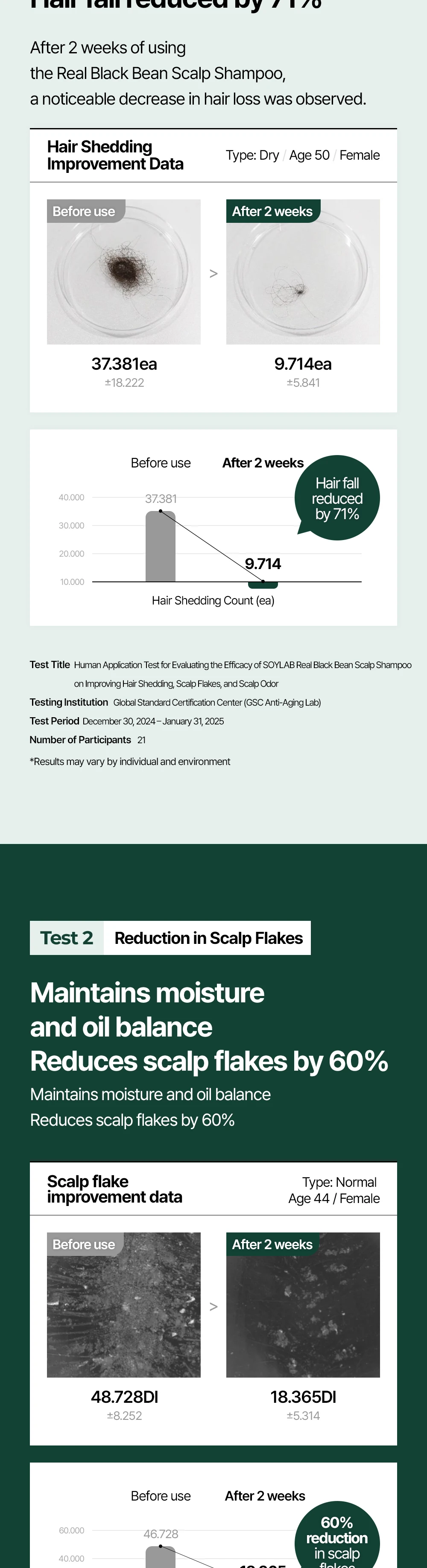 [SOY LAB] 500ml Curly Hair Scalp Care Gel Shampoo with Anti-Dandruff ...