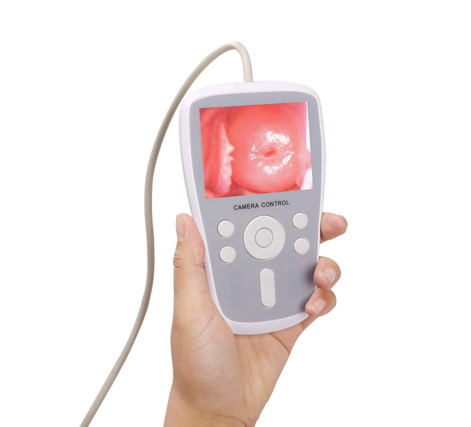 Digital Vaginal Speculum Camera Colposcope Digital Video Colposcope For ...