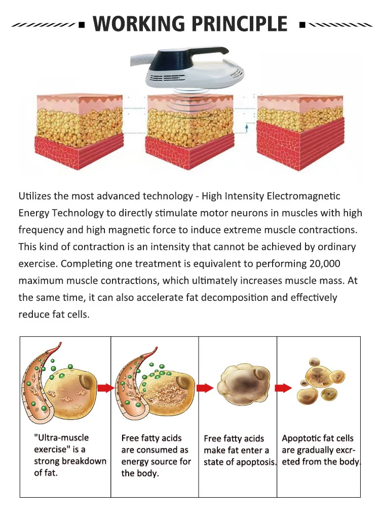 Ems Body Contouring Device Ems Abdominal Trainer Full-body Ems Workout ...