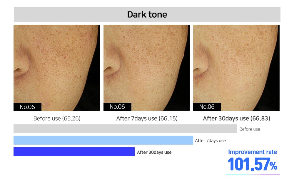 Korean Skincare Set Intensive Whitening Vitamin Three Type 7 Daus ...