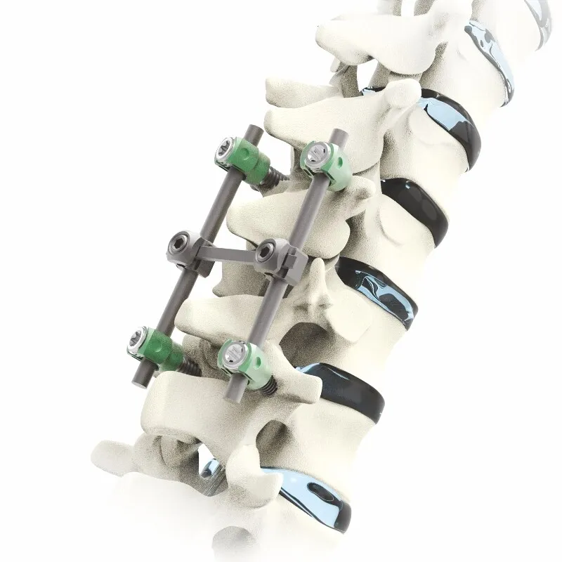 Cervical Intervertebral Fusion Cage System Peek Orthopedic Implant For ...