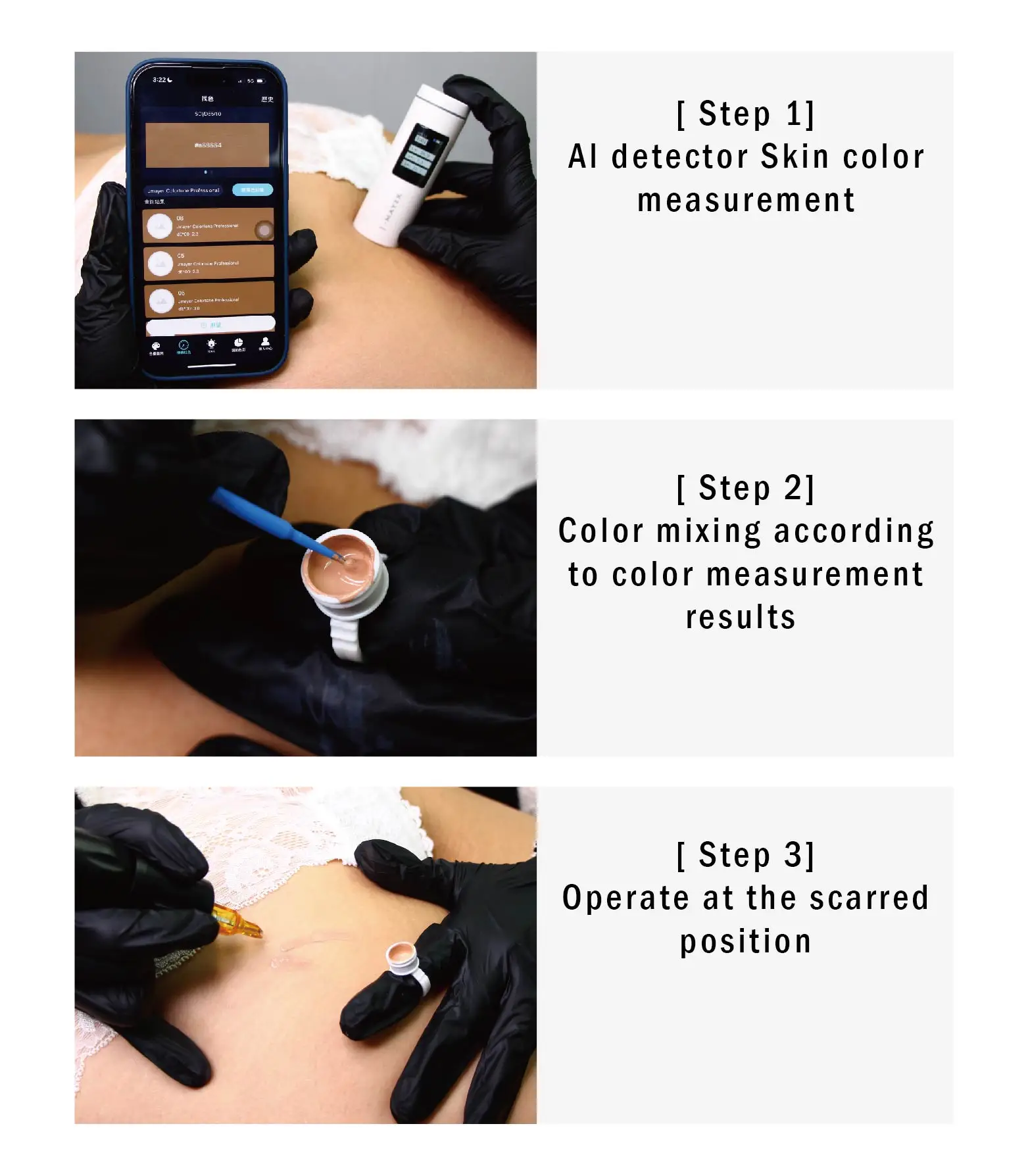 Skin Colorimeter - Buy Skin Colorimeter Product on Alibaba.com