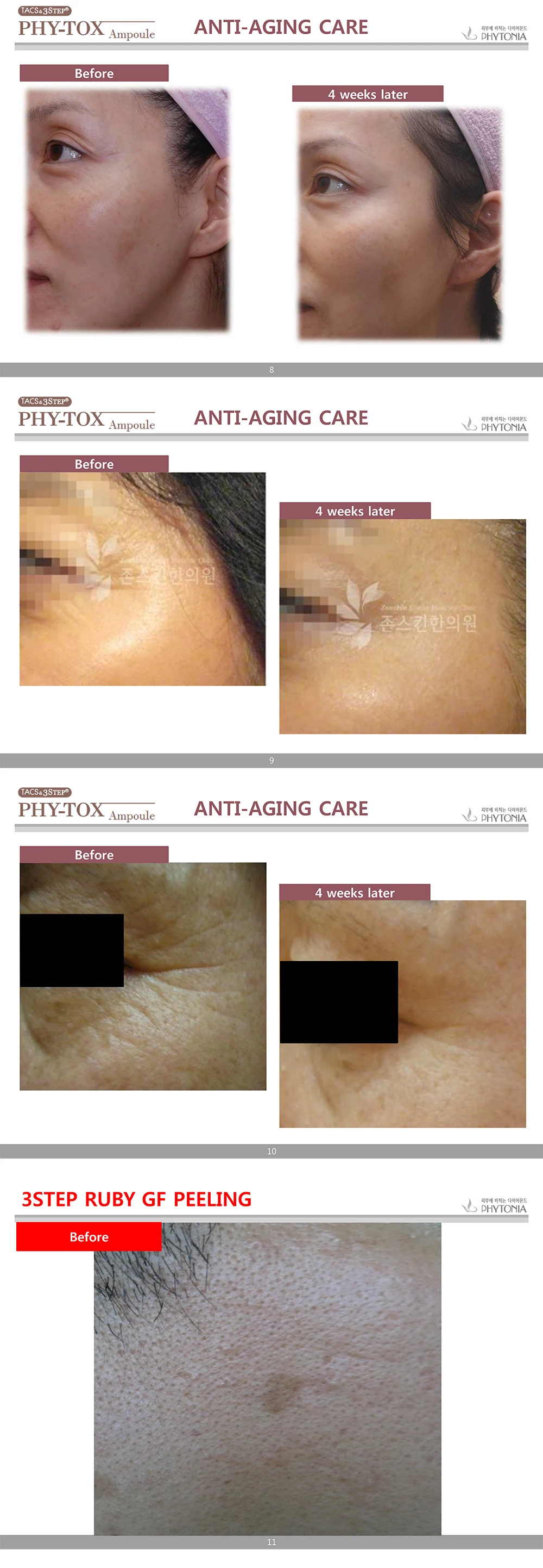 Phy-tox Senolytic Lotion Anti-aging And Cell Regeneration New Skincare ...