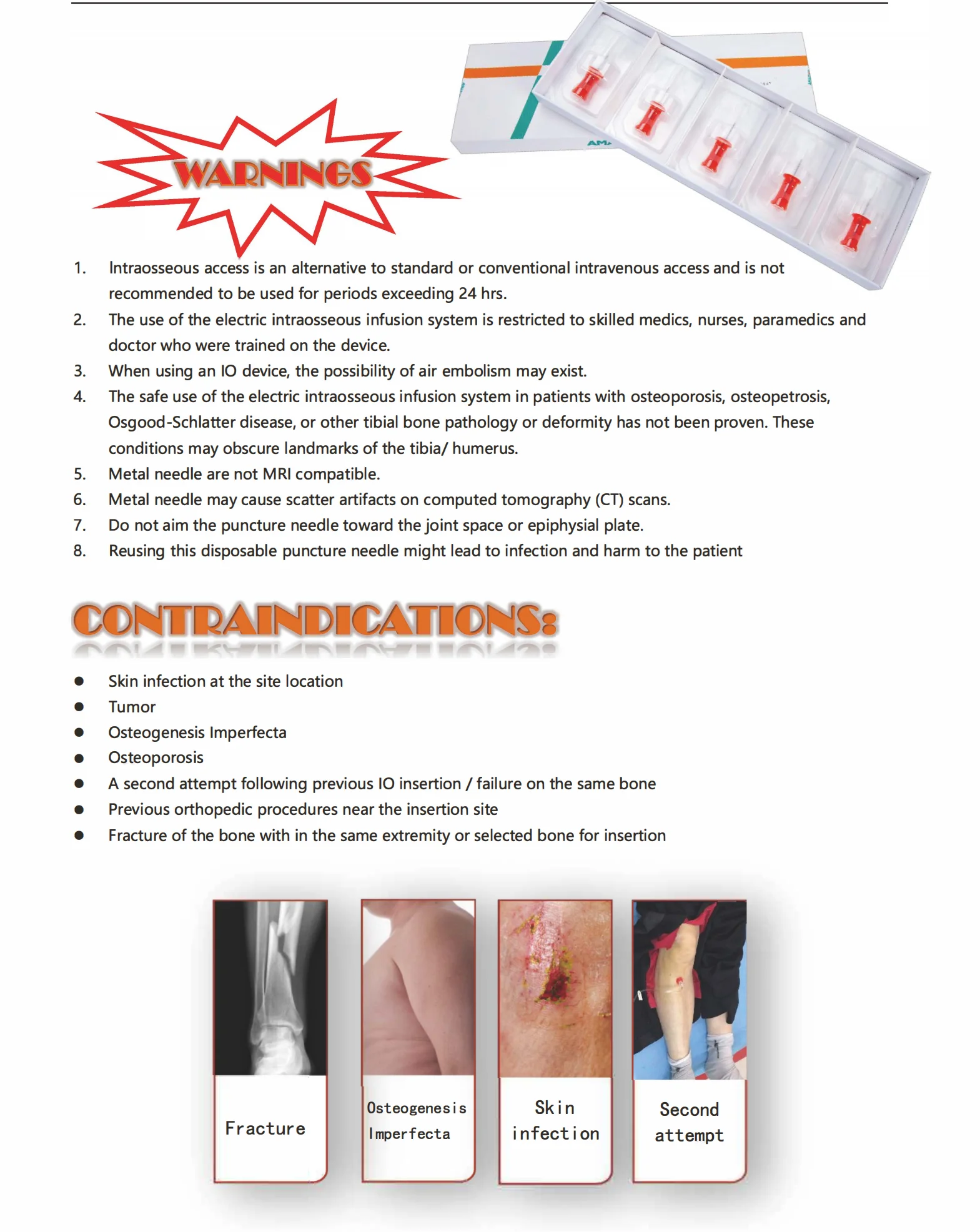 Electric Intraosseous Infusion System Bone Marrow Infusion System ...