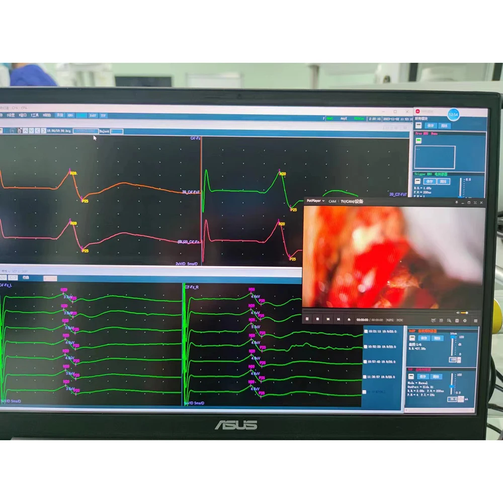 16 Channels Intraoperative Monitoring IONM System MSLCW37