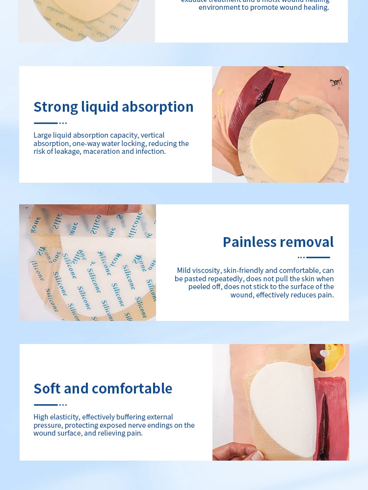 Factory Direct Selling Sacrum Bedsore Wound Care Skin Color Or Custom ...